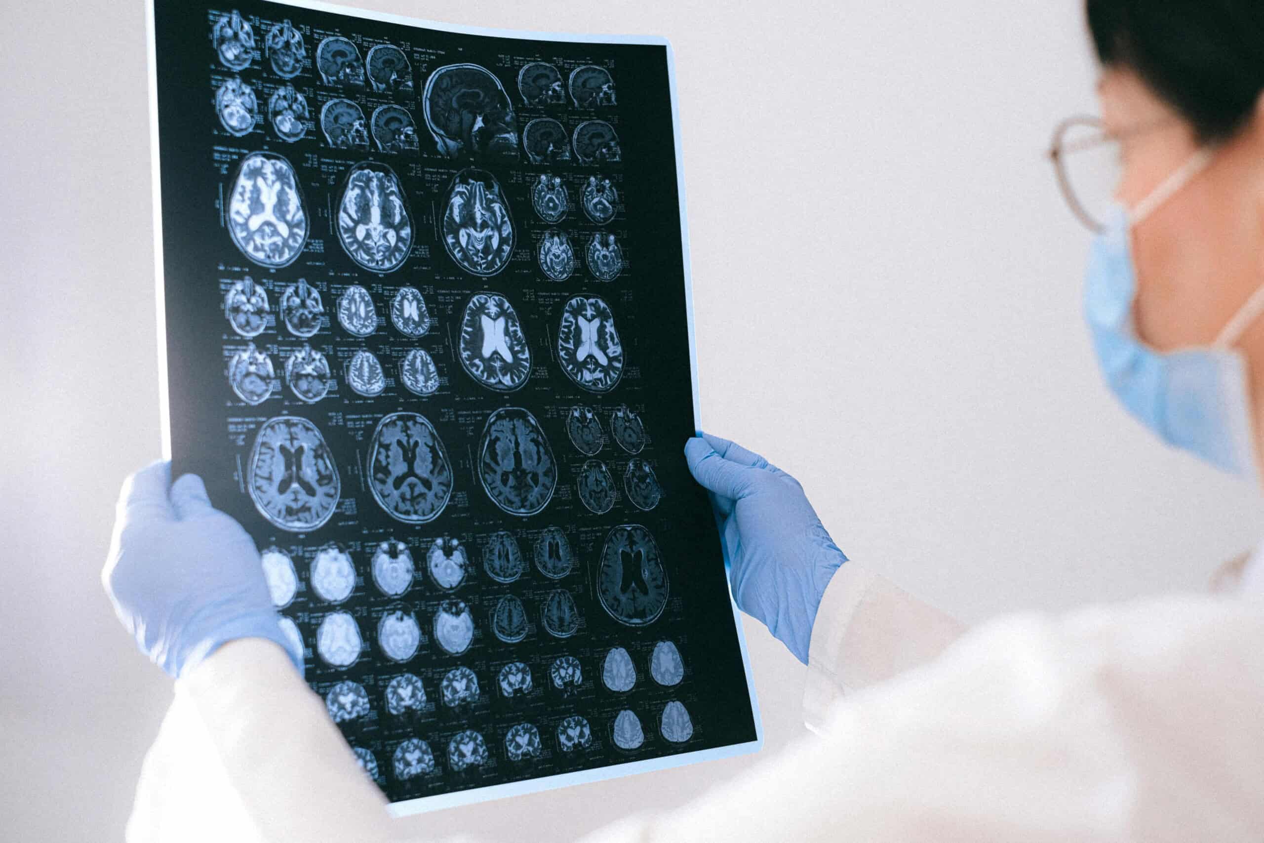The Triune Brain: How Trauma Affects Brain Development - Therapas
